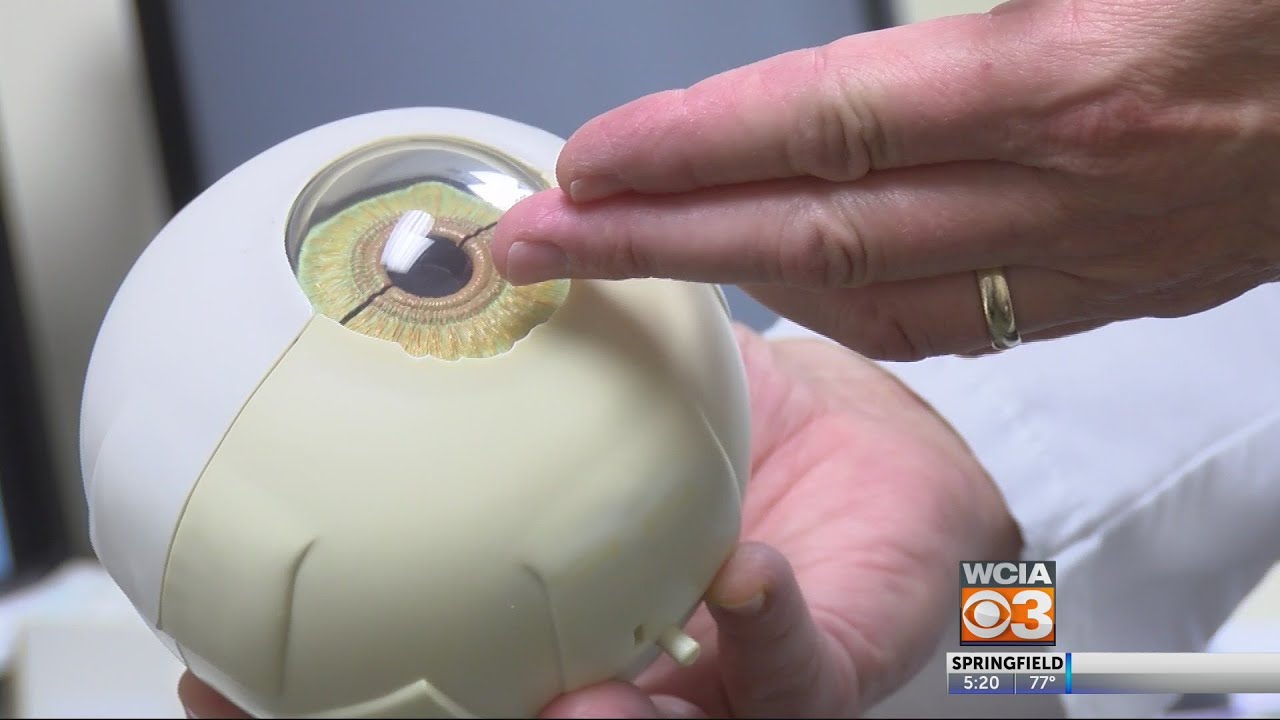 Rare eye infection - YouTube