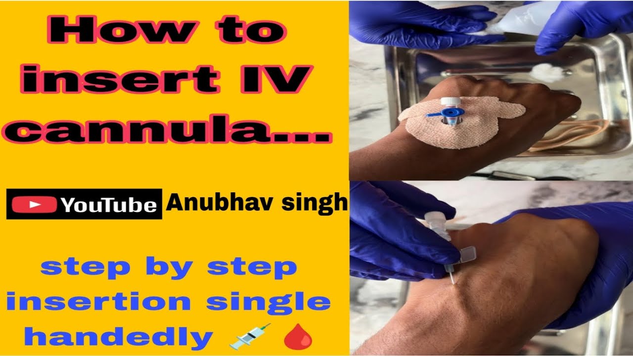 || How to insert IV cannula full process || step by step insertion ...