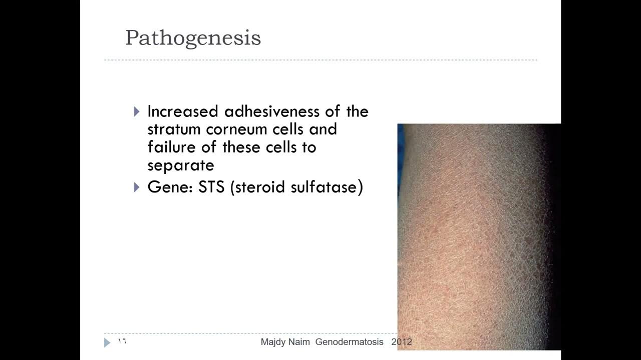 Dermatology Genodermatosis Youtube