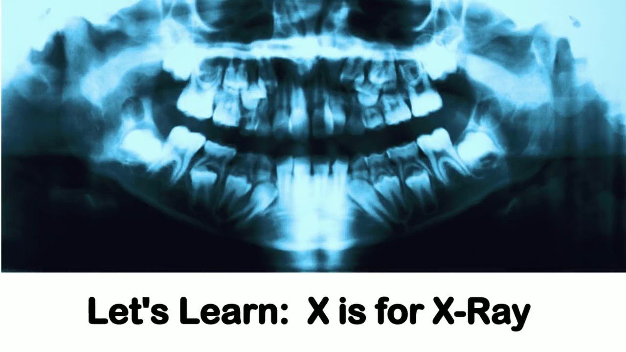 X is for X-ray - Children's Dental Academy - YouTube