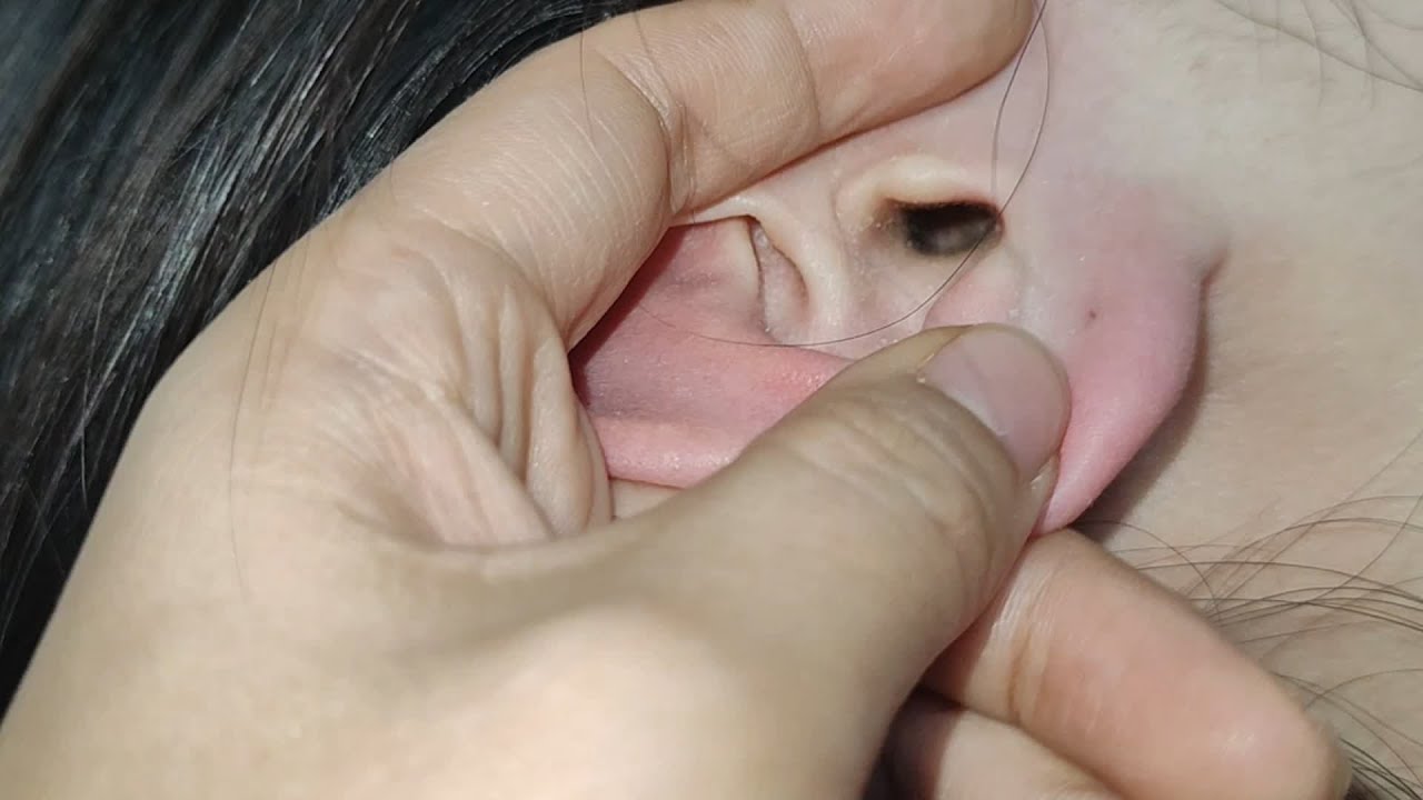 👂 Ultimate Ear Cleaning ASMR | Deep Relaxation & Tingling Sounds 🌿 - YouTube