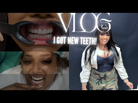 VLOG: I FLEW TO TURKEY & GOT MY TEETH DONE WITH DENTHUB - YouTube