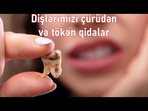 Diş çürüməsinin qarşısı necə alınır