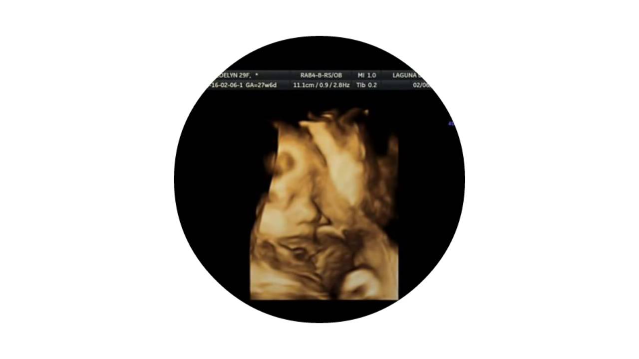 4D Ultrasound 27 weeks & 6 days - YouTube