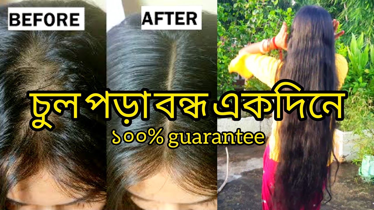 Hair Fall and Hair Growth Treatment at Home in Bangla | Home Remedy for ...