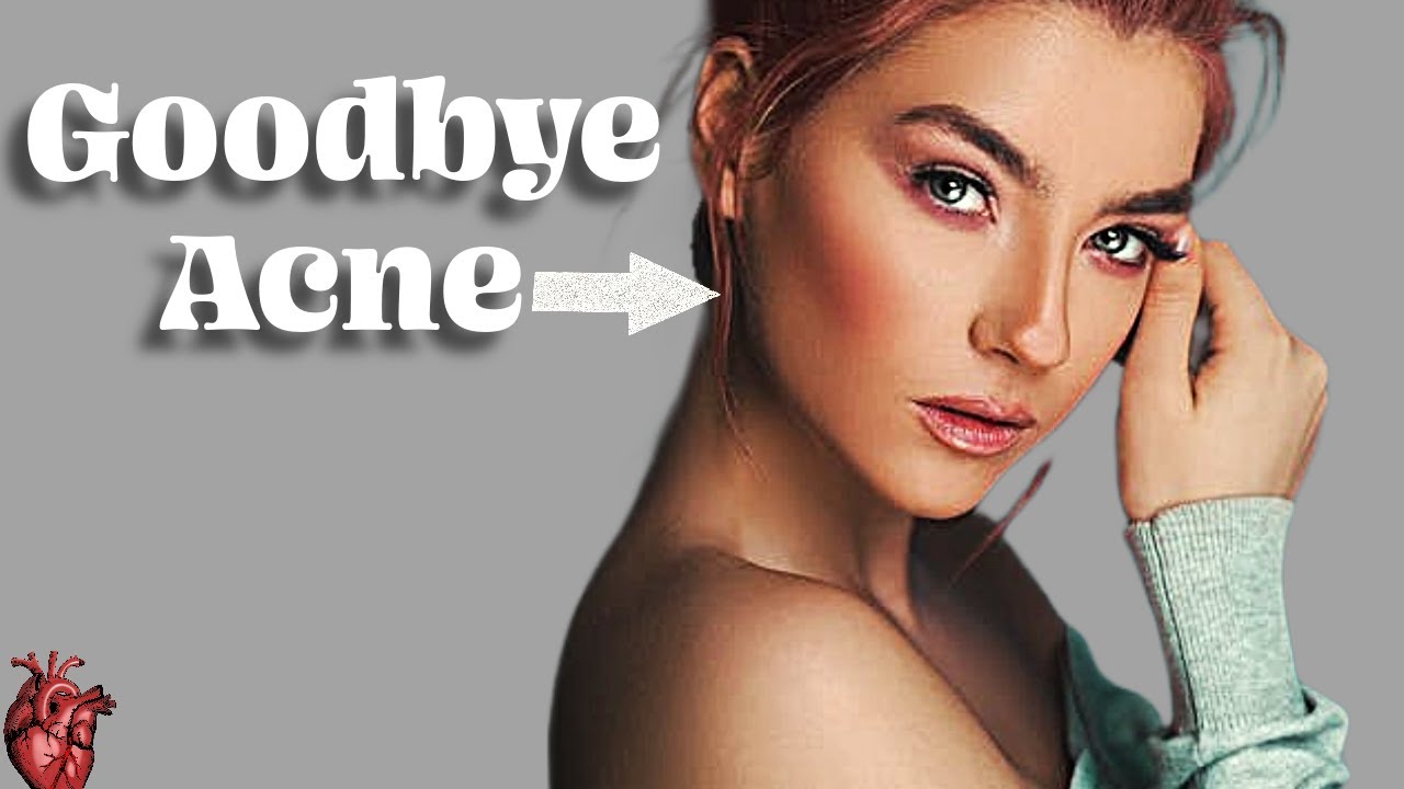 The Ultimate Guide To Clear Skin: Collagen Works Wonders! - YouTube