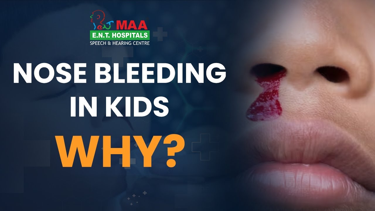 Nose Bleed In Kids | Reasons & Treatment | MAA ENT Hospital | Nasal ...
