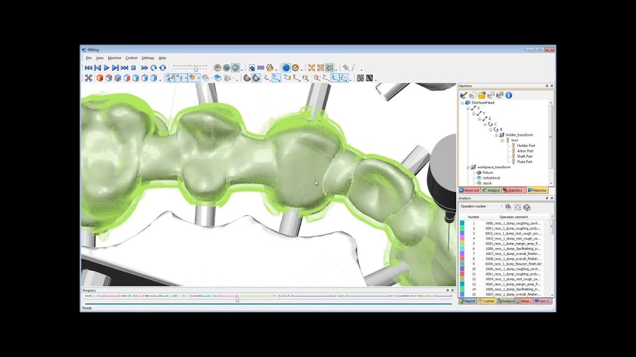 ModuleWorks Webinar: Dental CAM - Latest Developments in Toolpath ...