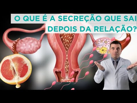 Secreção que sai depois do sexo