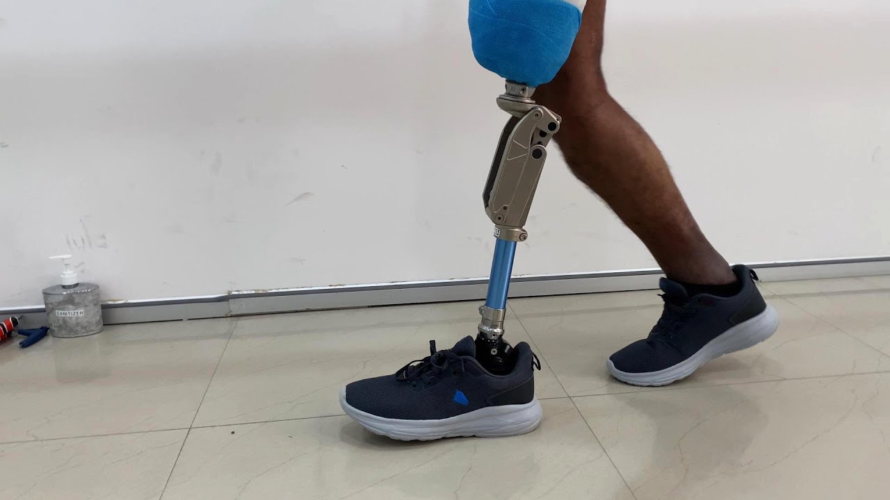 OHP3 Knee with Proflex LP Align Foot - YouTube
