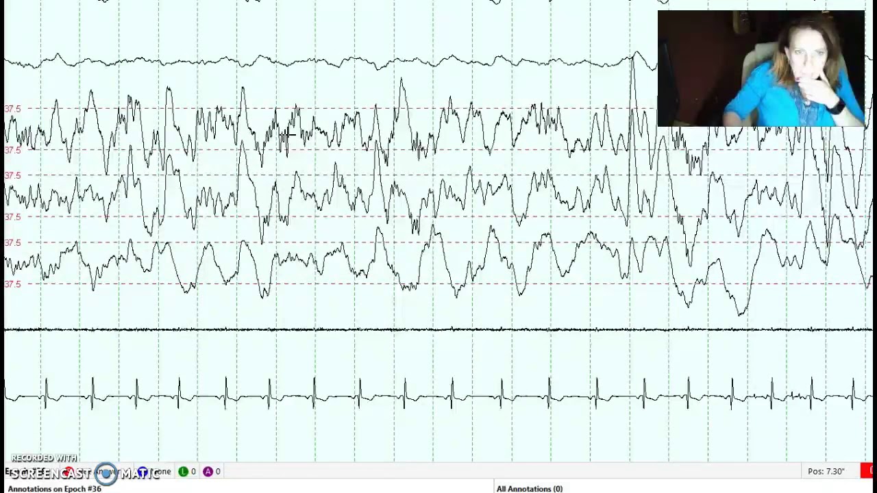 Overview of AASM ISR - YouTube