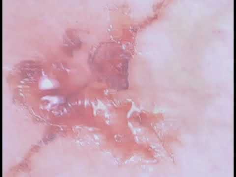 Self Portrait, Blood on Screen - YouTube