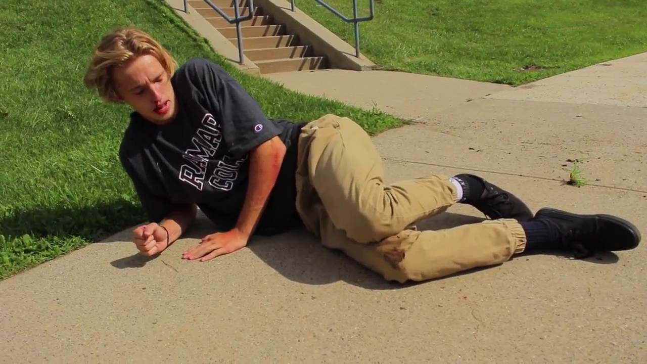 Justin Seiller - BMX Snapped Leg - YouTube