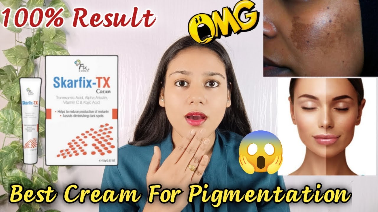 Fixderma Skarfix-Tx Cream Review|Best Treatment for Melasma and ...