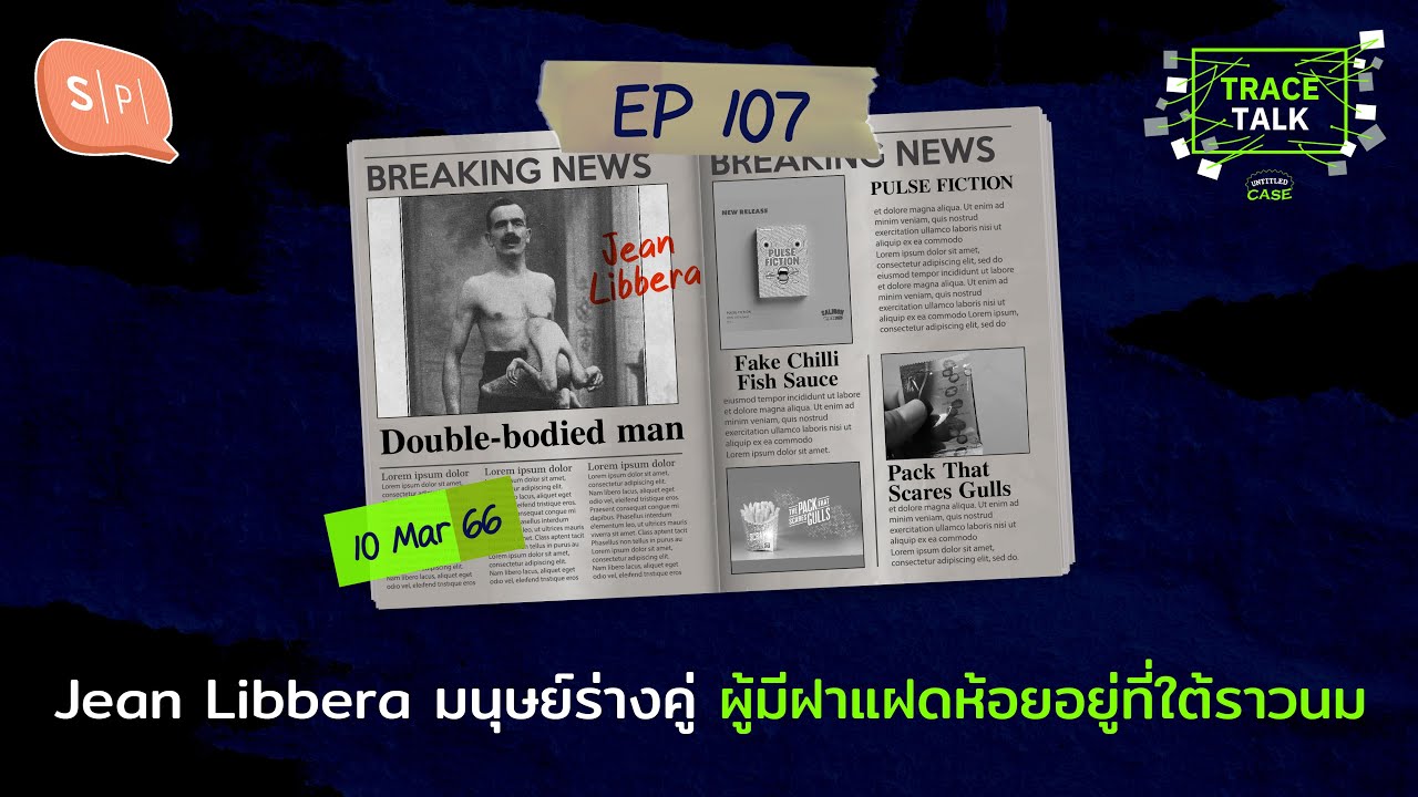 Jean Libbera มนุษย์ร่างคู่ ผู้มีฝาแฝดห้อยอยู่ที่ใต้ราวนม | Trace Talk ...