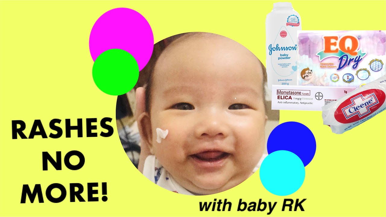 Gamot sa RASHES ni baby! (PREVENTION & CURE) ||vlog5 - YouTube
