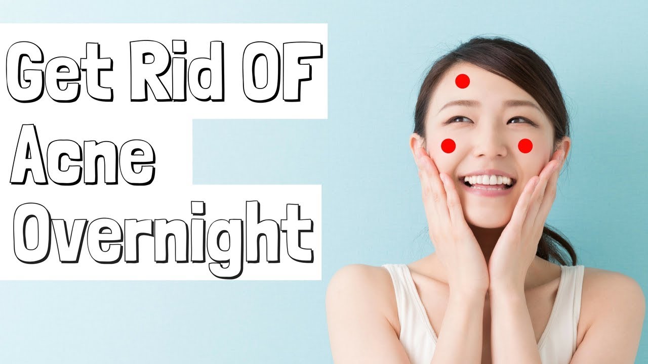 How to get rid of acne overnight (guaranteed results) - YouTube