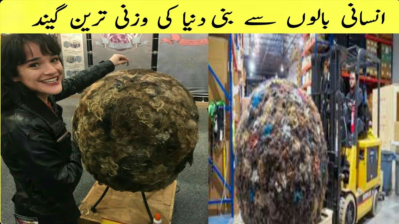The World's Heaviest Human Hair Ball |Hair Ball |Big Hair Ball ...