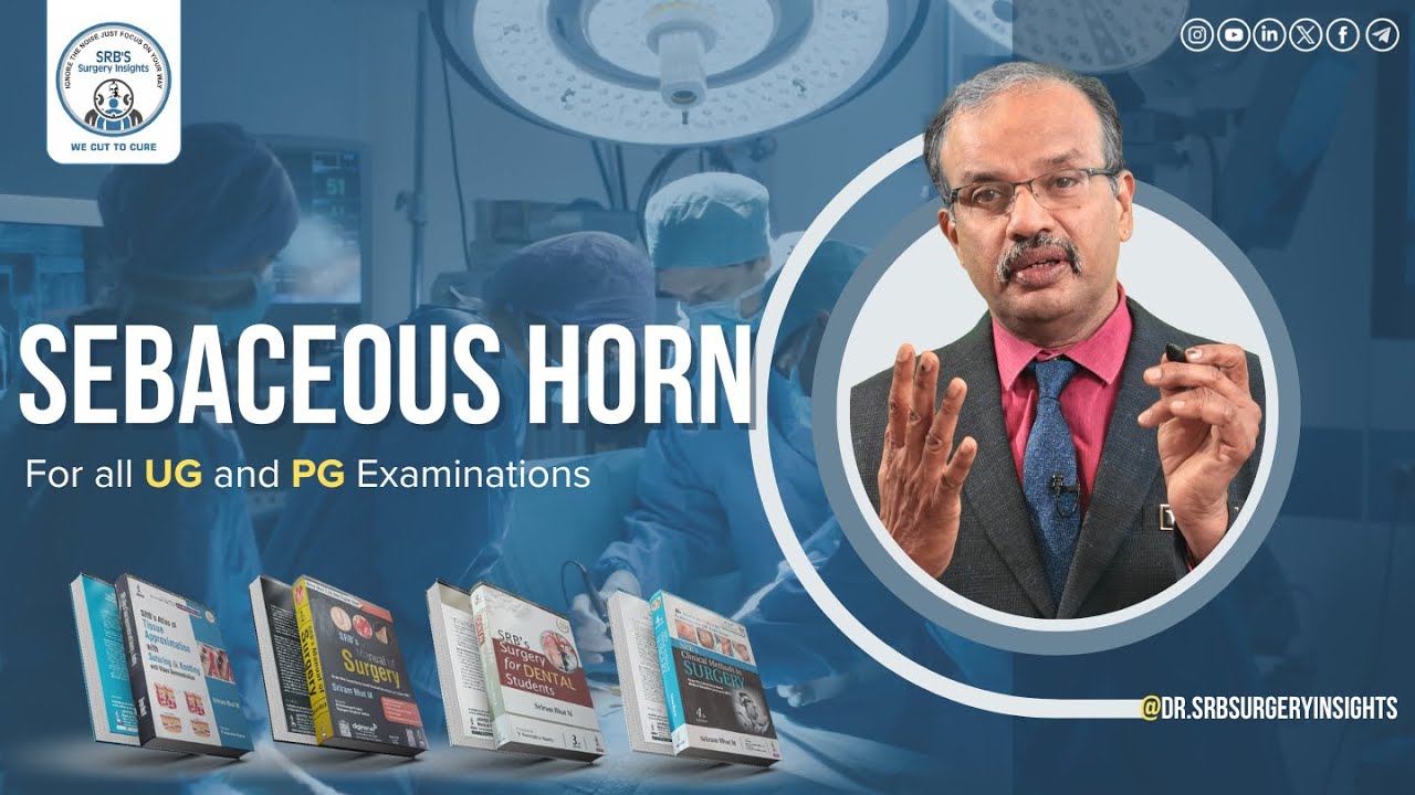 Sebaceous Horn by Dr. SRB | Dr. Srirama Bhat - YouTube