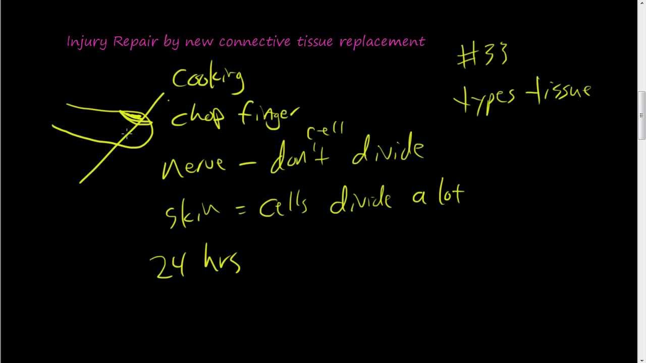 #38-The 4 step process overview of tissue repair after injury - YouTube