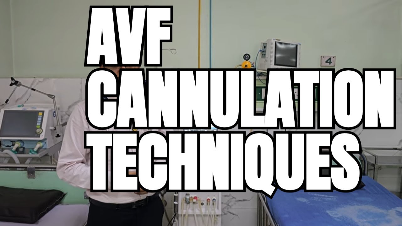 Techniques of AVF cannulation : THE COMPLETE HEMODIALYSIS SERIES - YouTube