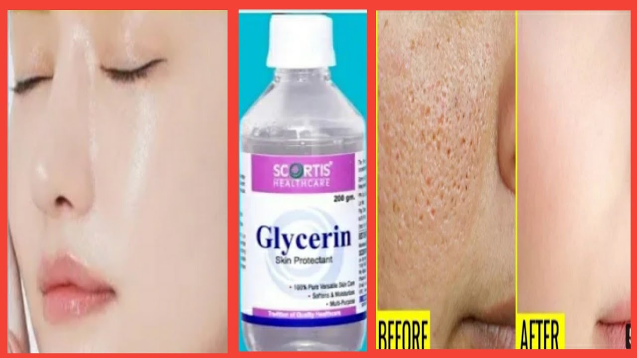 Glycerin for Skin Whitening and Glowing Skin | How to Apply glycerin on ...