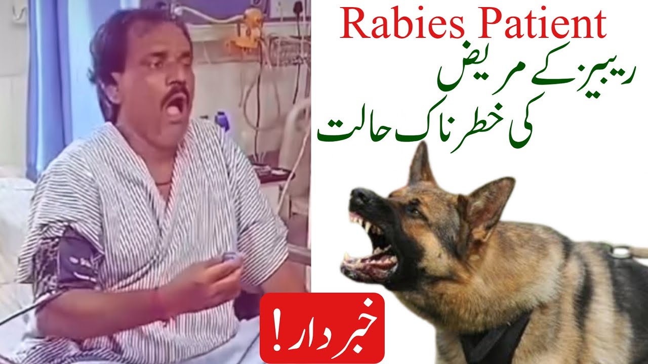 Rabies Patient| Symptoms of Rabies| Hydrophobia in Rabies Patient| Doc ...