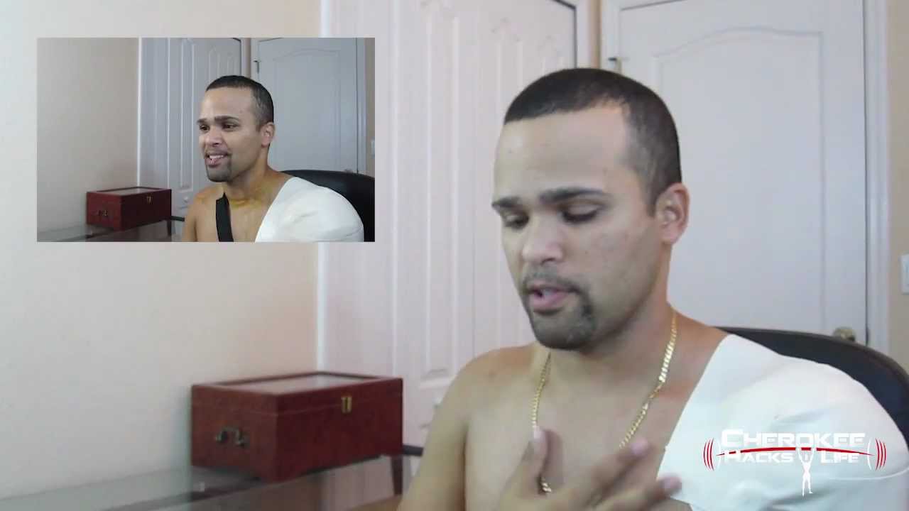 How to remove Surgical Iodine - YouTube