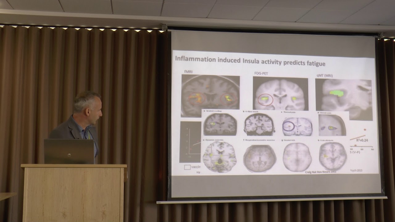 CMRC Conference 2017 day 2 - Dr Neil Harrison - YouTube