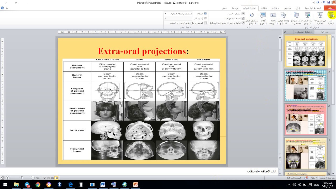 extraoral projections lec 12 part 1 new - YouTube