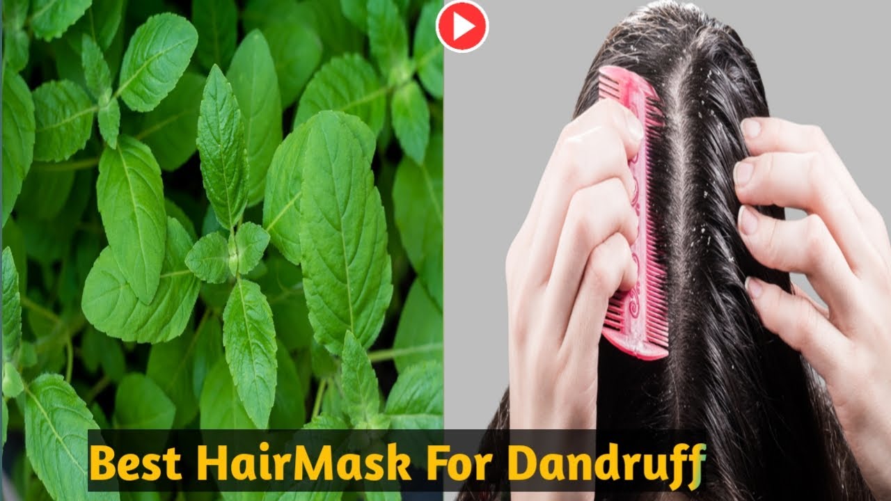 Magical Home Remedy to Remove DANDRUFF At Home Within 5 Minute || How ...
