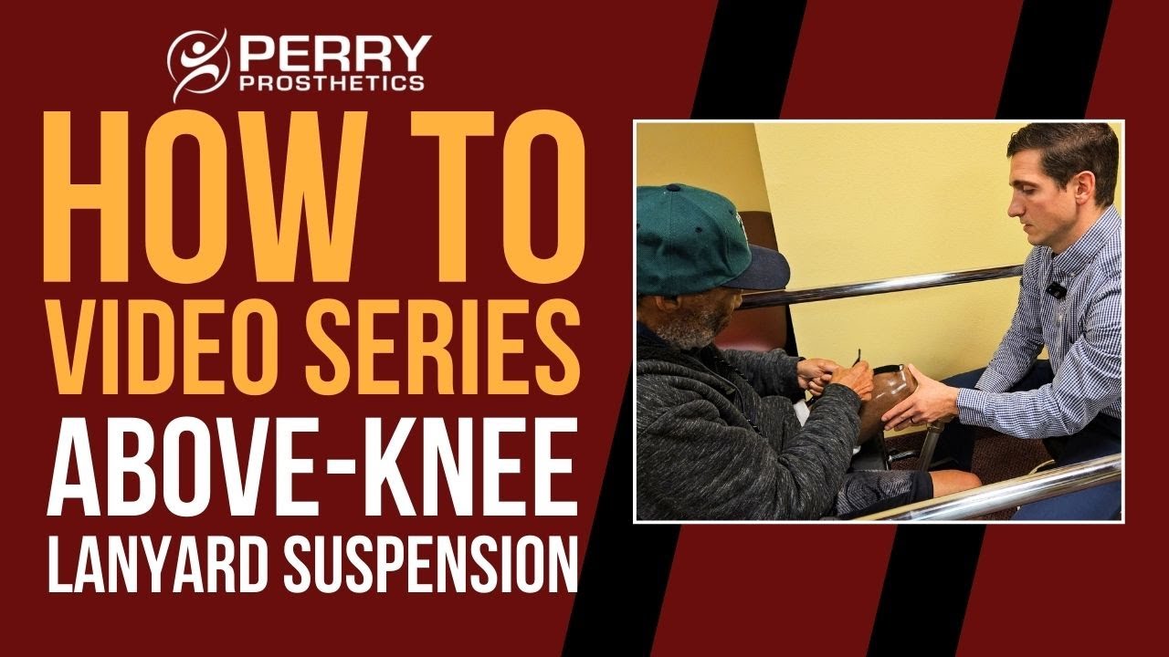 Above Knee Prosthetic Lanyard Suspension: How-To Series - YouTube
