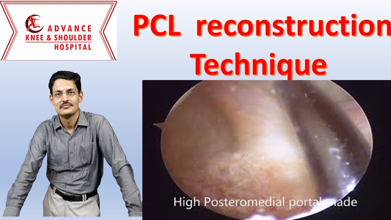 PCL reconstruction (surgical steps) - YouTube