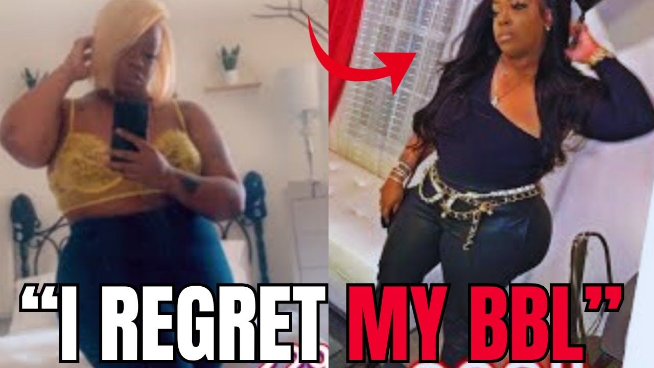 SHE THOUGHT A BBL WAS GOING TO CHANGE HER LIFE BUT NOW SHE REGRETS IT ...