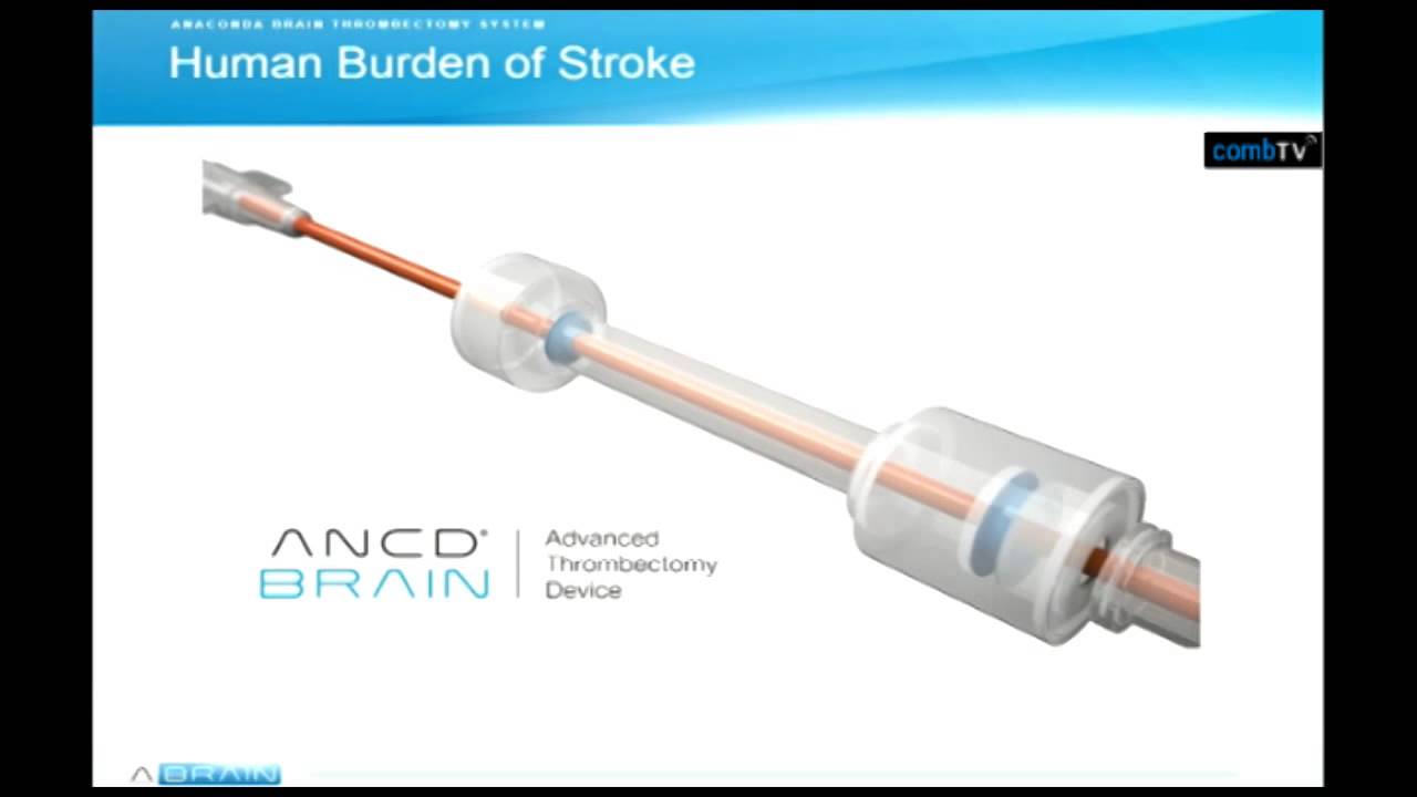 13 XV FòrumHealthcare: Anaconda BioMed (Dispositius i equips mèdics ...