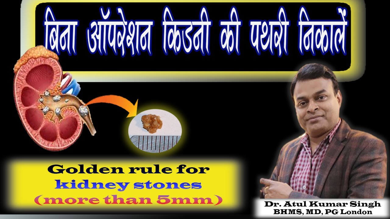 Remove kidney stone | गुर्दे की पथरी को जल्दी ठीक करें | pathri ka ilaj ...