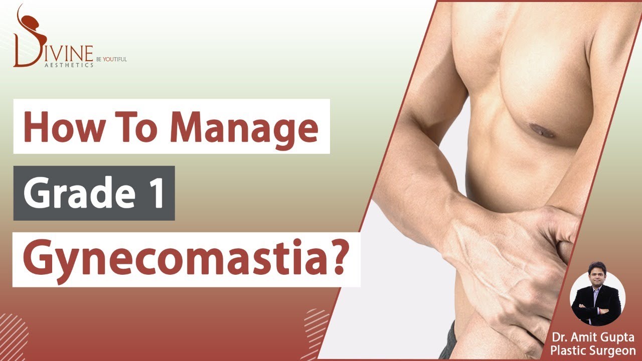 How to Manage Grade 1 Gynecomastia? - YouTube