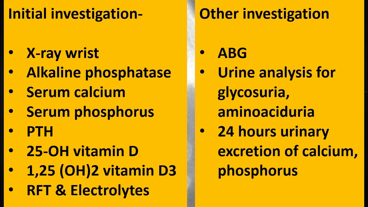 Approach to a case of rickets (Part 3/3) | Rickets | Pediatrics - YouTube