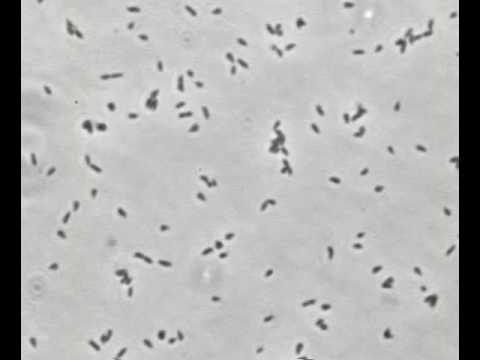 Mycoplasma gallisepticum gliding phase.mpg - YouTube