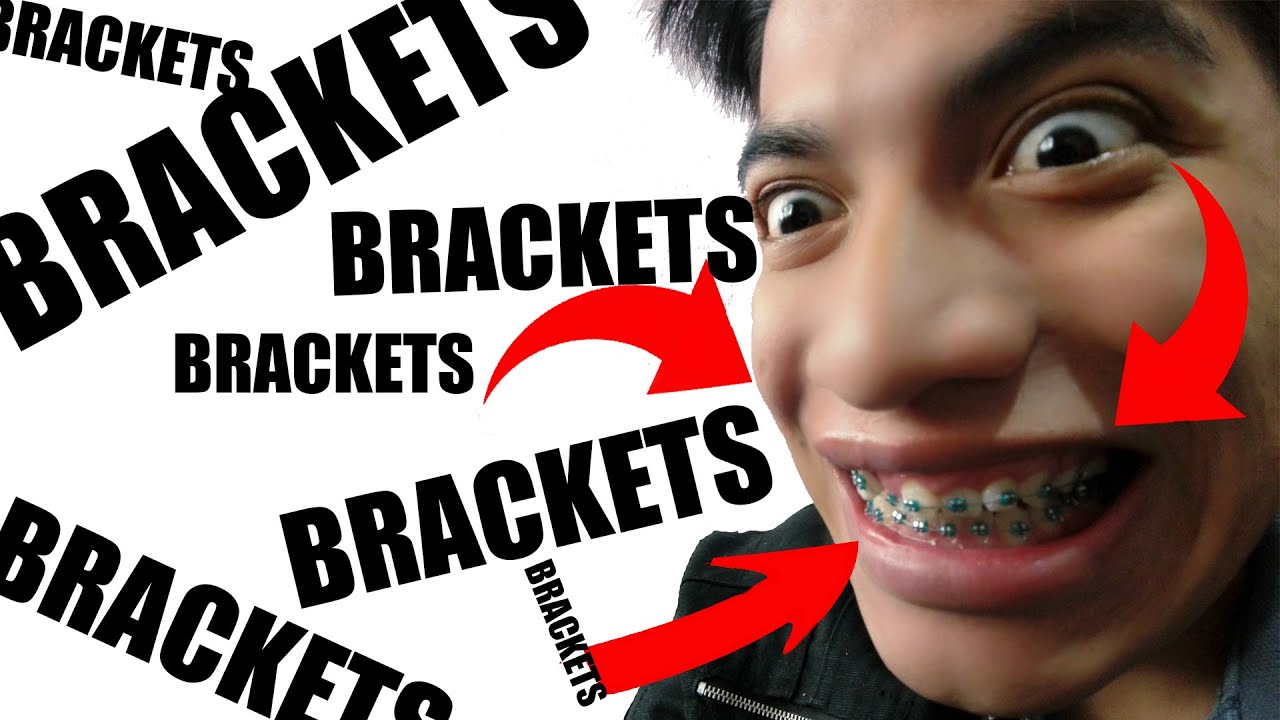 MI HISTORIA CON BRACKETS 6 MESES - YouTube