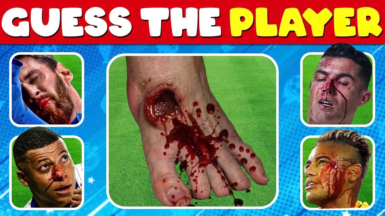 The Most Horrific Injuries In Football History - YouTube