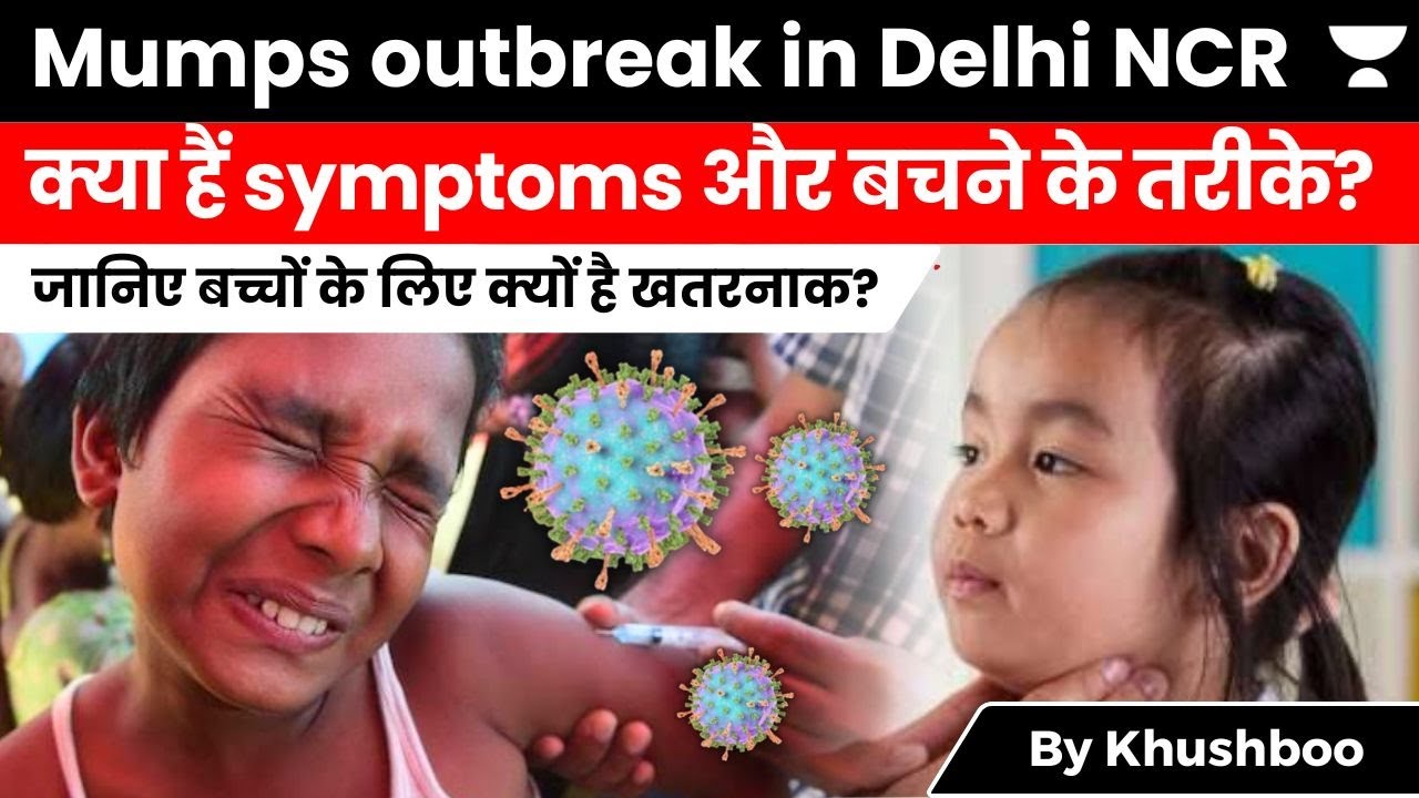 MUMPS outbreak in Delhi and other states. Children are the most ...