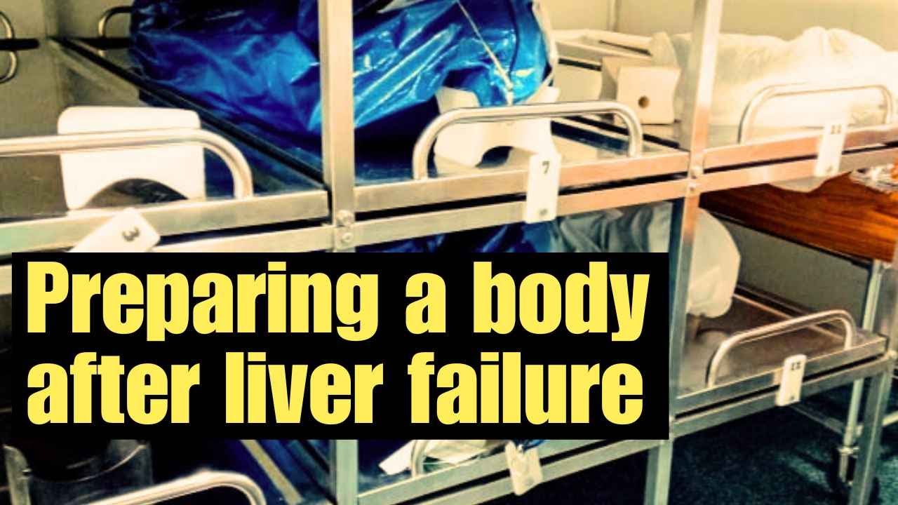Preparing a yellow, bloated body for viewing - YouTube