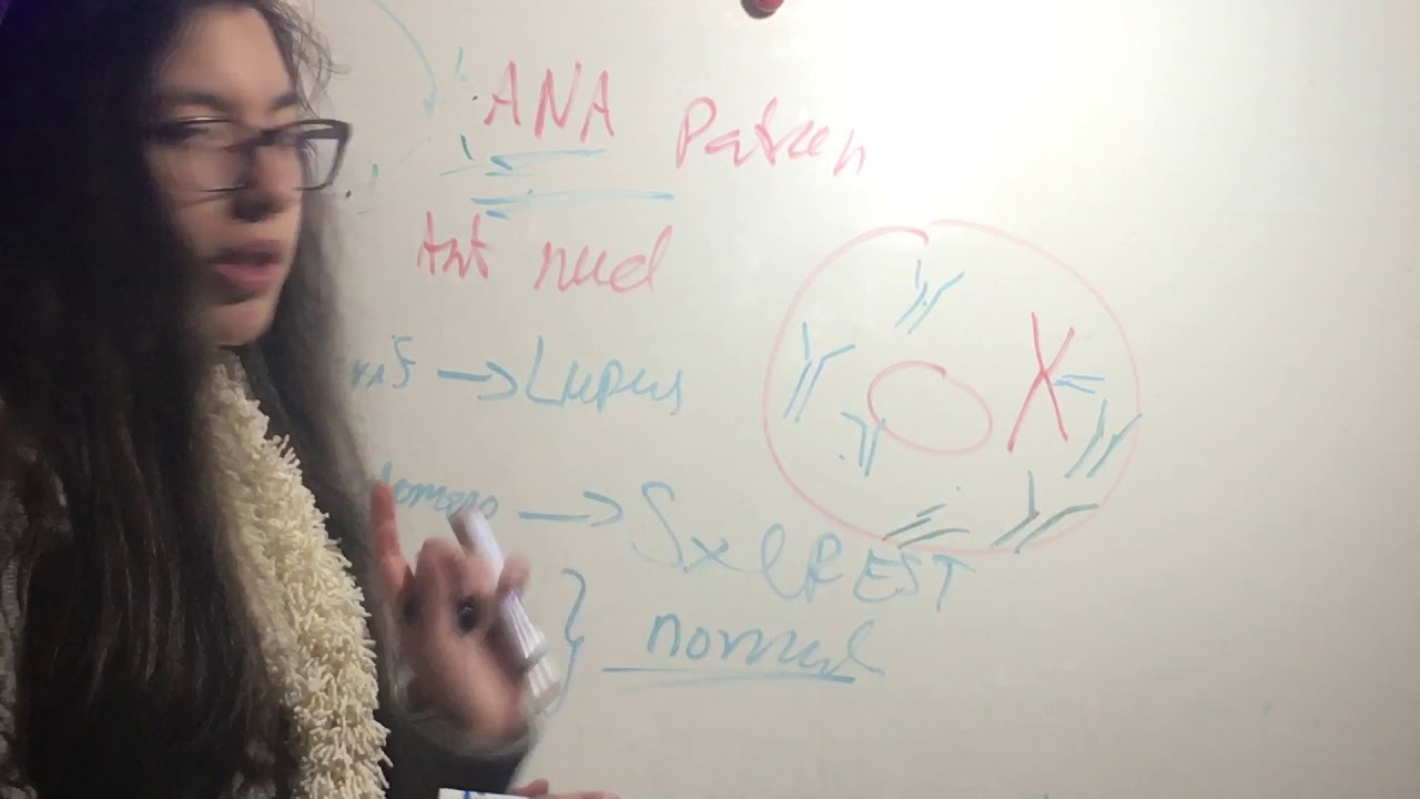Diagnóstico Diferencial Dependiendo del Patrón de ANA - YouTube
