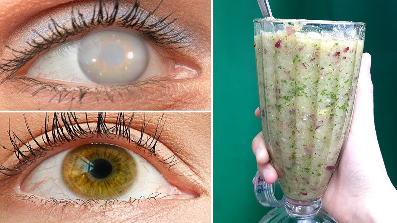 Prévenir La Vision Floue Et Améliorer Sa Vue Seulement Avec Cette ...