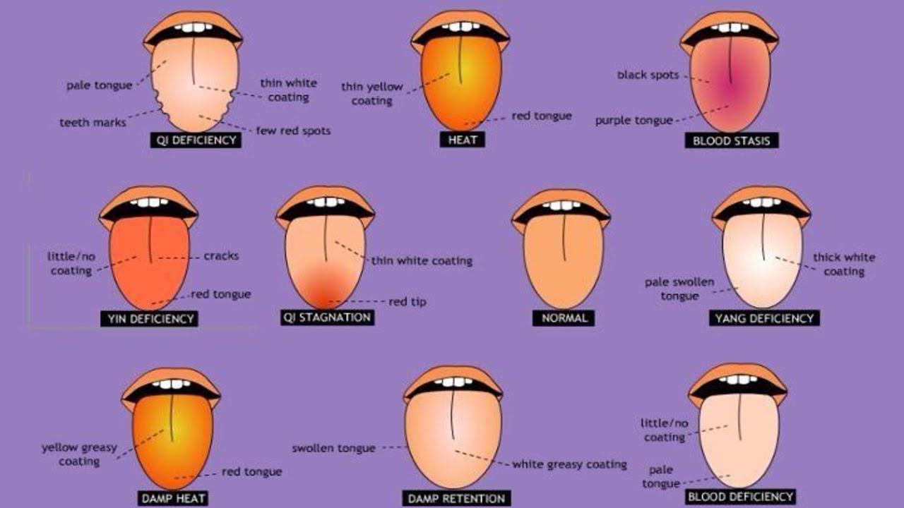 TONGUE MATTERS 04: Tongue Body Color - YouTube