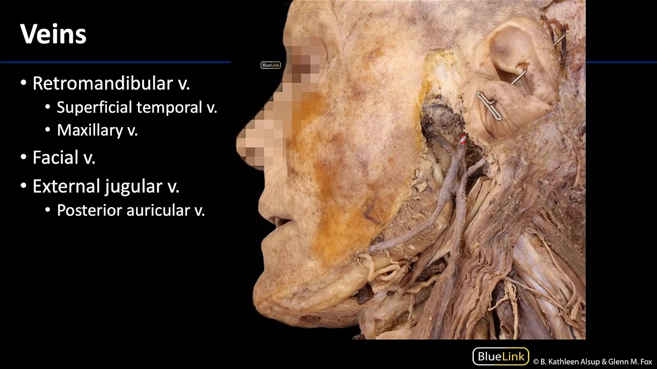 Retromandibular Vein Cadaver