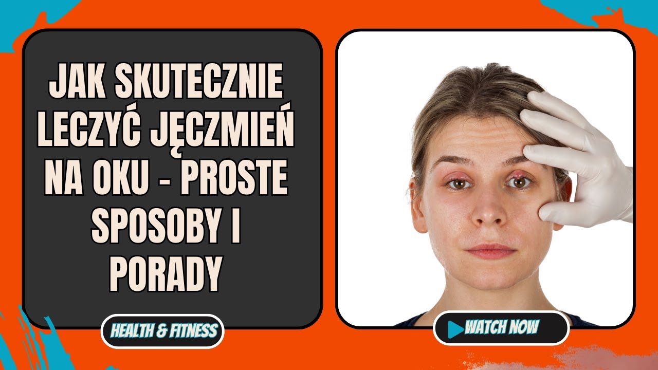 Jak skutecznie leczyć jęczmień na oku – proste sposoby i porady - YouTube