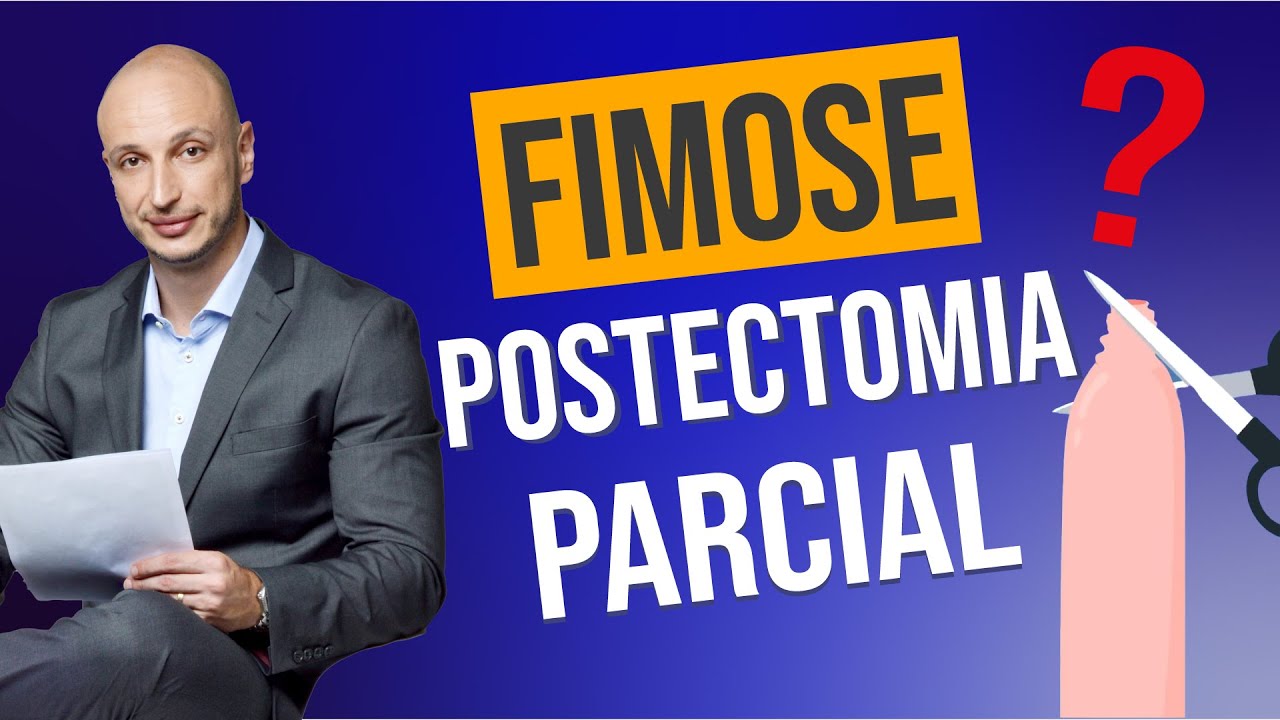 FIMOSE Postectomia Parcial como funciona? - Dr. Paulo Esteves - YouTube