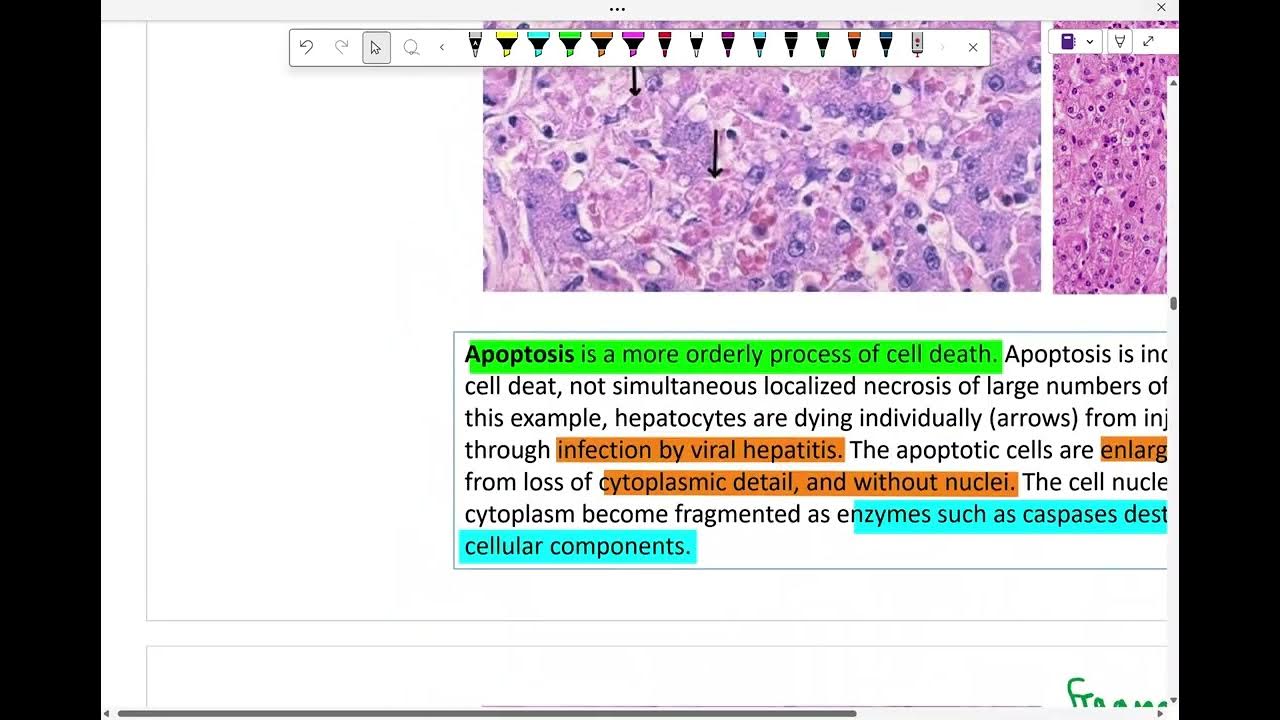 Intro to pathology (Cell injury Lab (2) Cell death) - YouTube